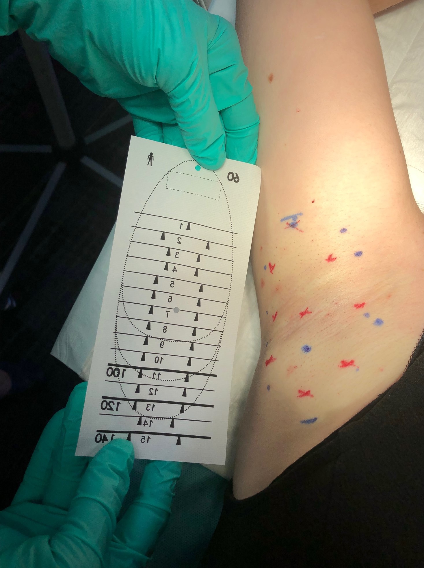 The Hyperhidrosis Treatment Plastic Surgeons Are Loving